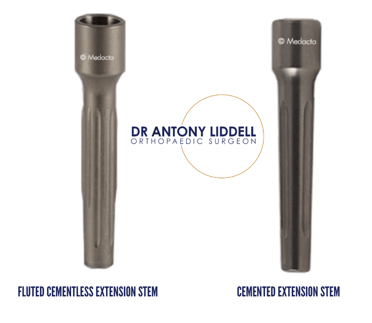 Revision Knee Replacement Surgery - Dr Antony Liddell